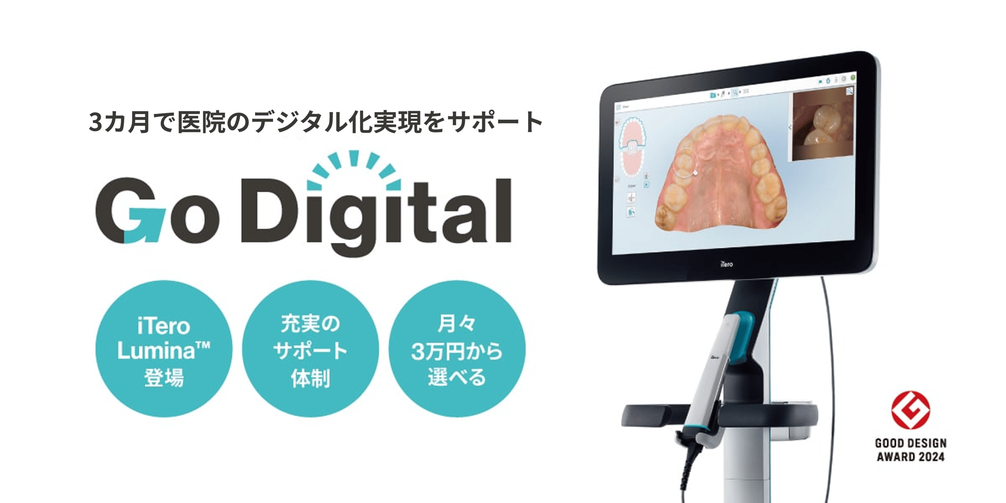 iTero の3カ月レンタル Go Digital